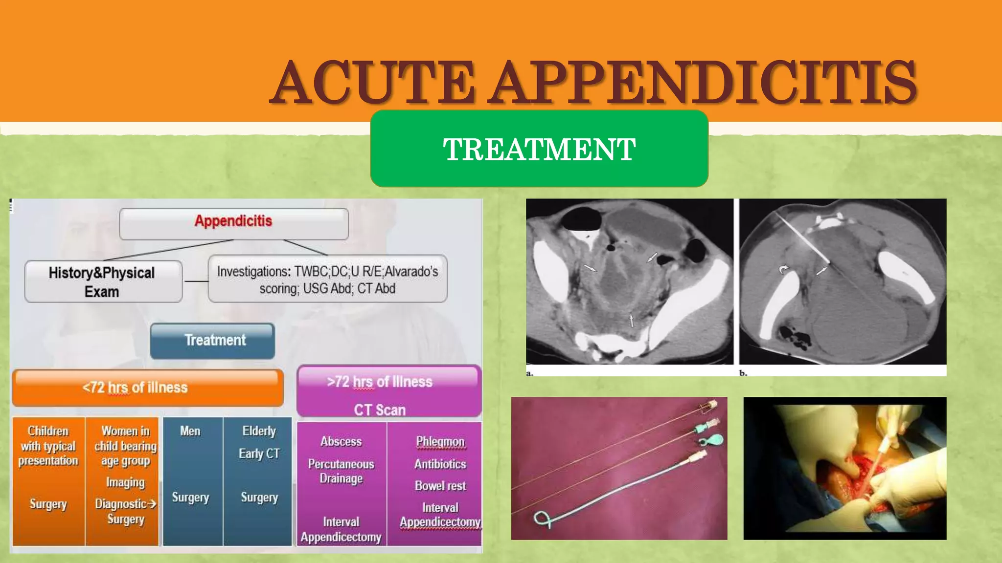 Acute appendicitis / RLQ Pain | PPTX