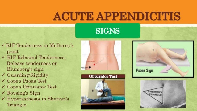 Acute appendicitis / RLQ Pain
