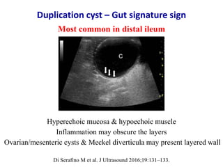 First Signs Appendicitis
