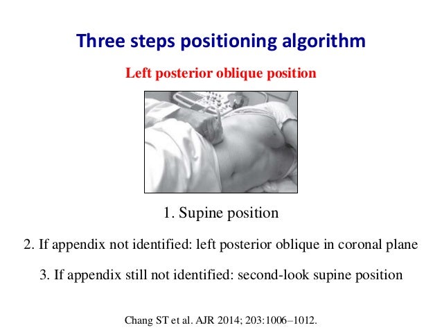 Acute appendicitis - Ultrasound first