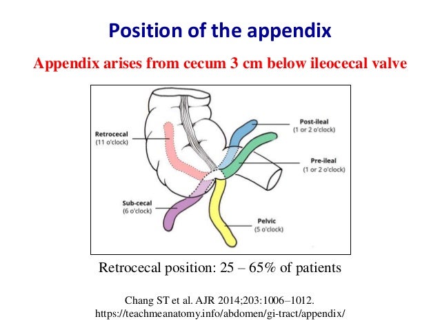 Acute appendicitis - Ultrasound first