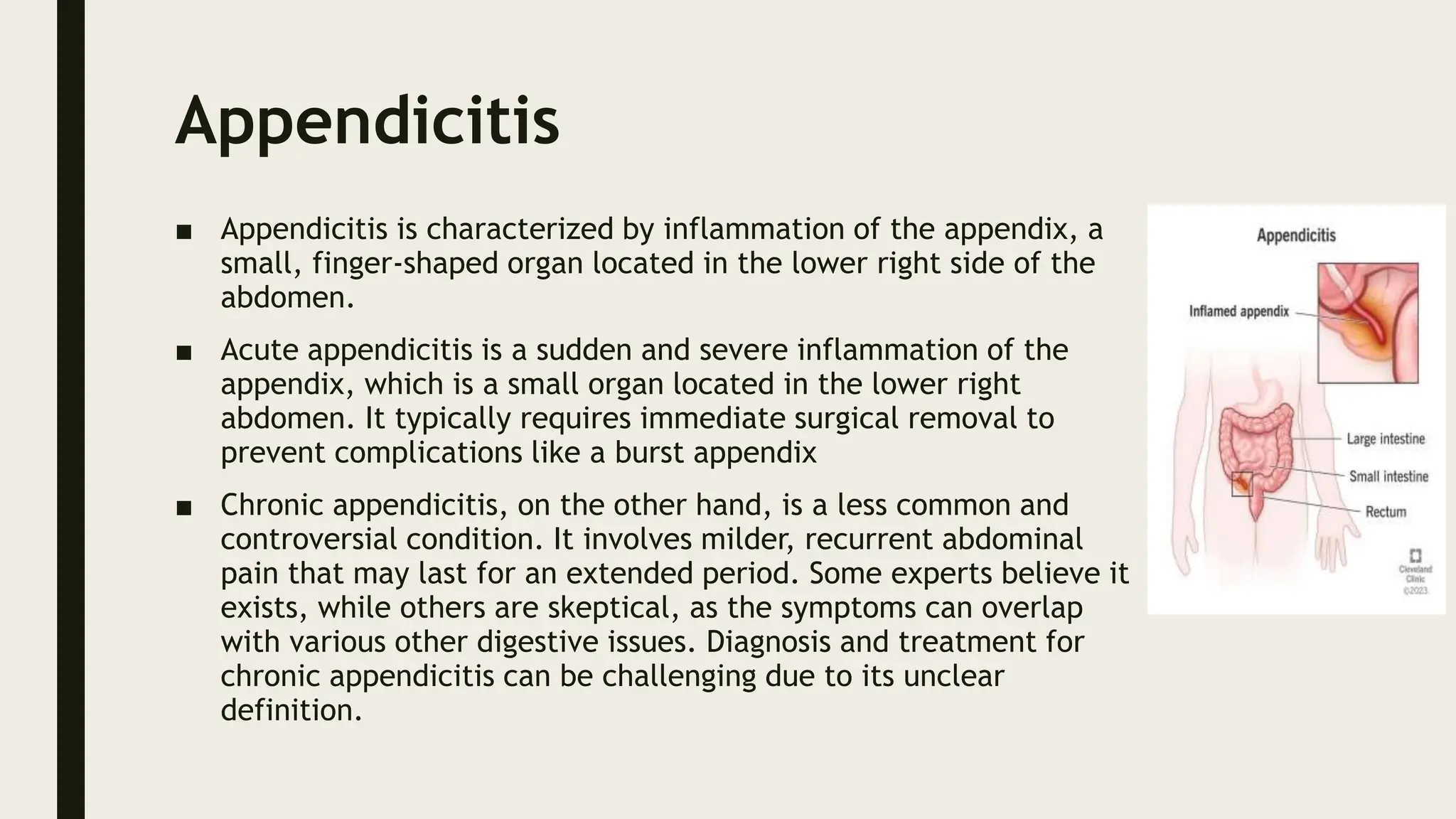 Acute appendicitis .pptx