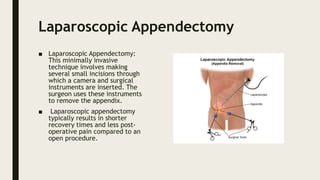 Acute appendicitis .pptx