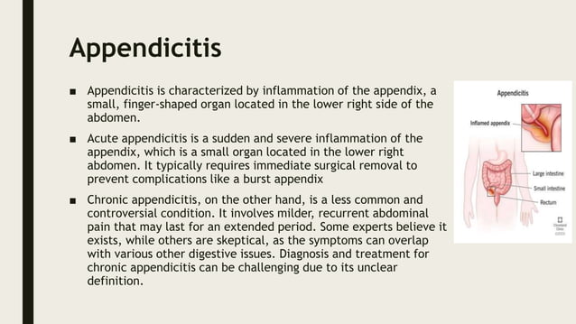 Acute appendicitis .pptx