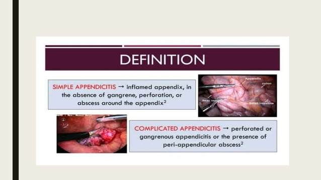 Acute appendicitis .pptx