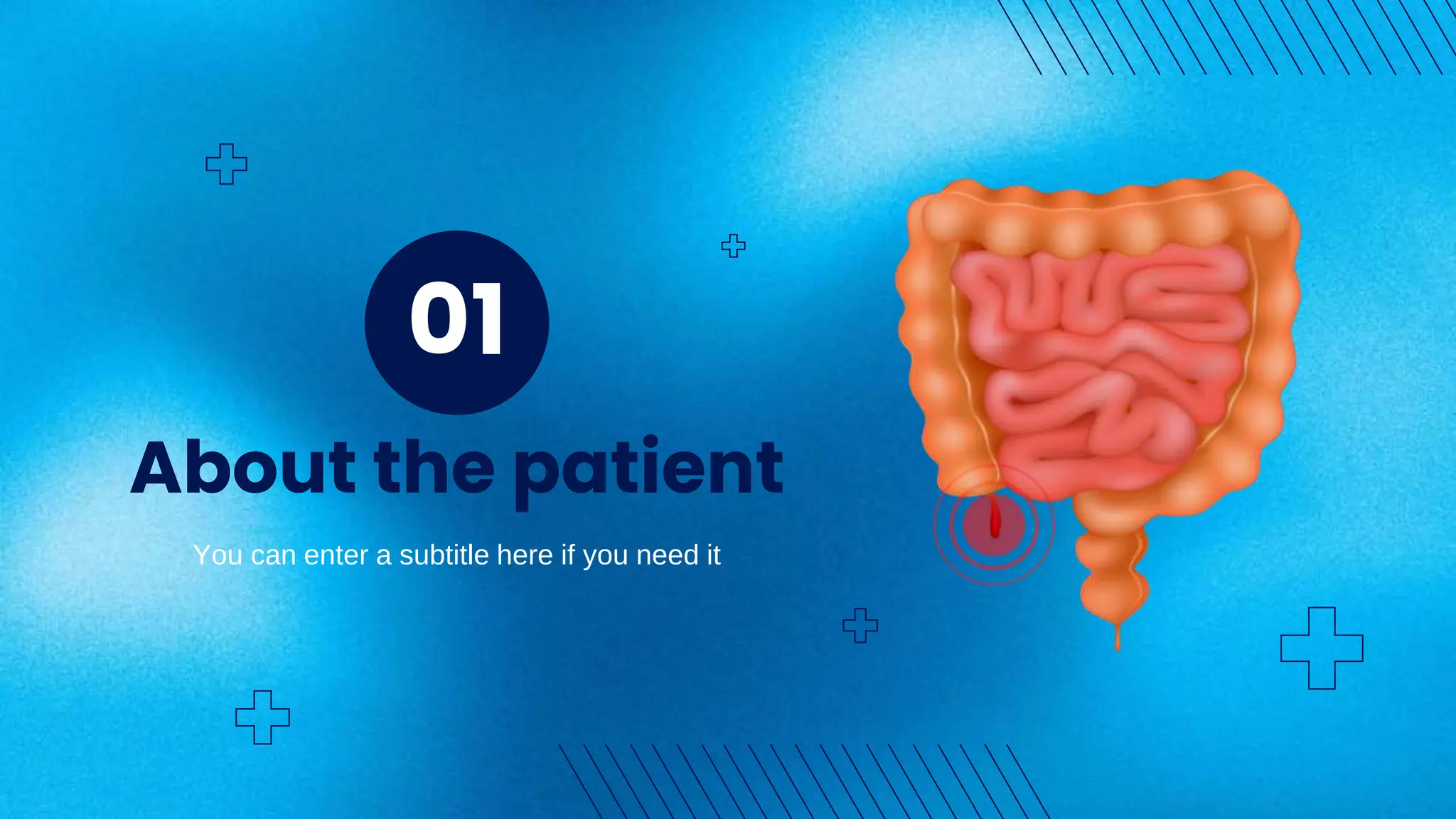 Acute Appendicitis Clinical Case by Slidesgo.pptx