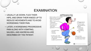 Acute appendicitis easy to diagnose | PPT