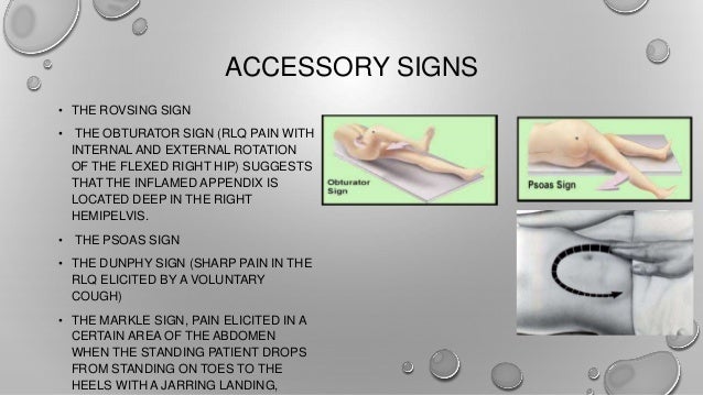 Acute Appendicitis Easy To Diagnose acute-appendicitis-easy-to-diagnose