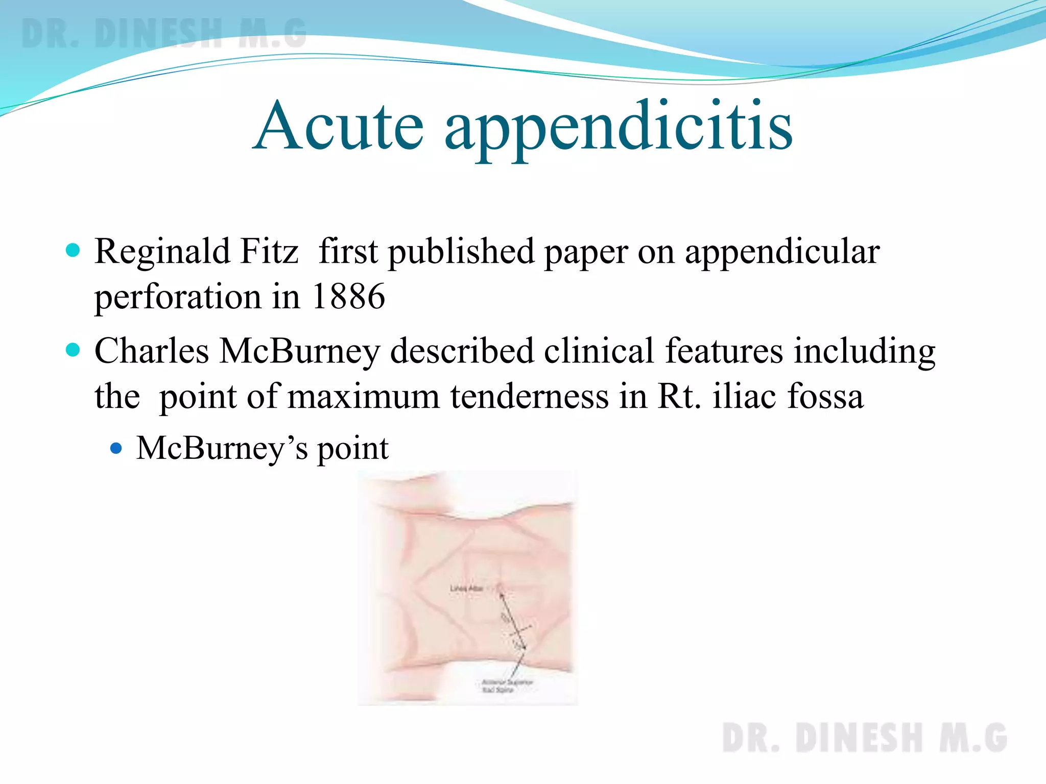 Acute Appendicitis | PPTX