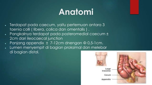 Acute Appendicitis FIX.pptx