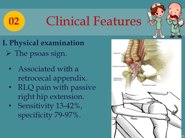 Acute appendicitis in adults - Hoang Cuong HMU | PDF | Digestive ...