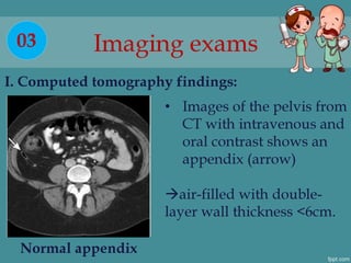 Acute appendicitis in adults - Hoang Cuong HMU | PDF