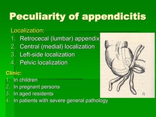 Acute appendicitis(lecture vasilevsky v.p.) | PDF
