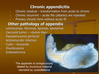 Acute appendicitis(lecture vasilevsky v.p.) | PDF