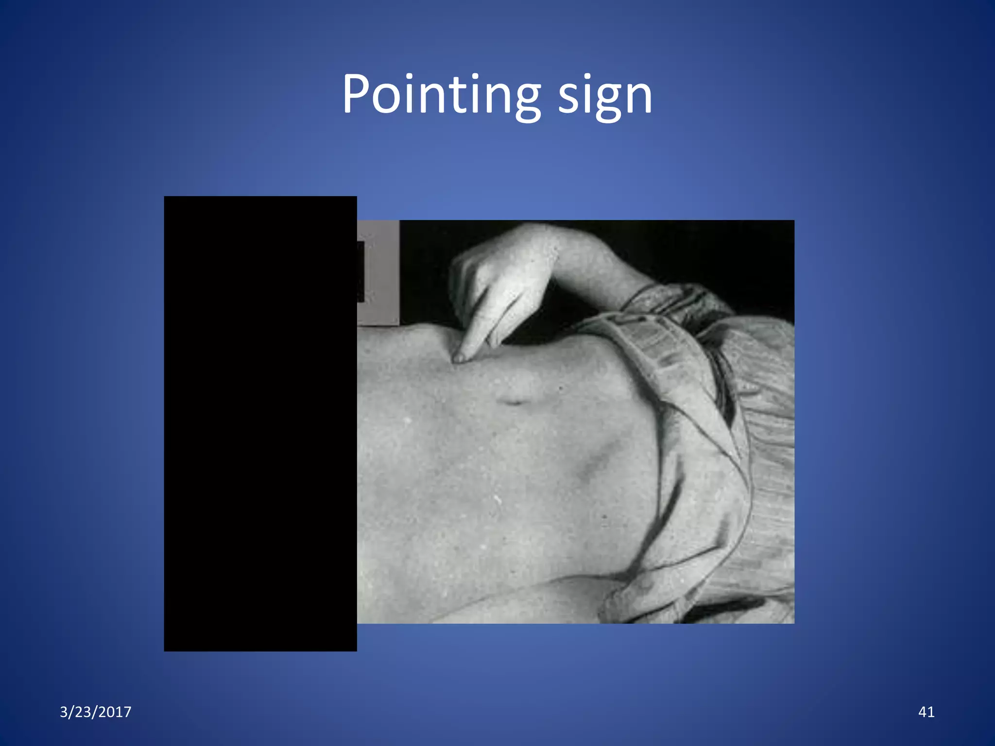 Acute appendicitis &lump | PPTX