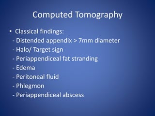 Acute appendicitis &lump | PPTX