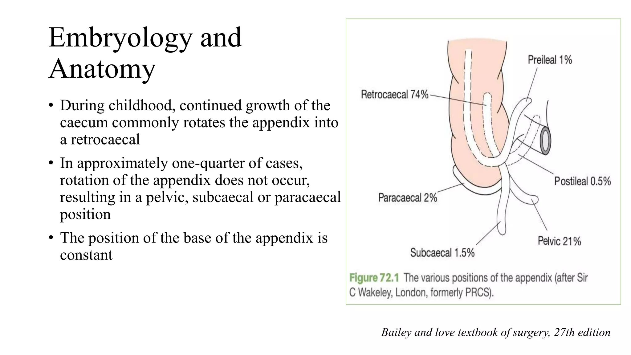 Acute Appendicitis | PPTX