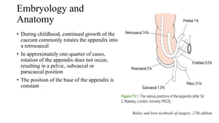acute appendiscitis .kkkkkkkkkkkkkkkkkkkkkkkkkk.pdf