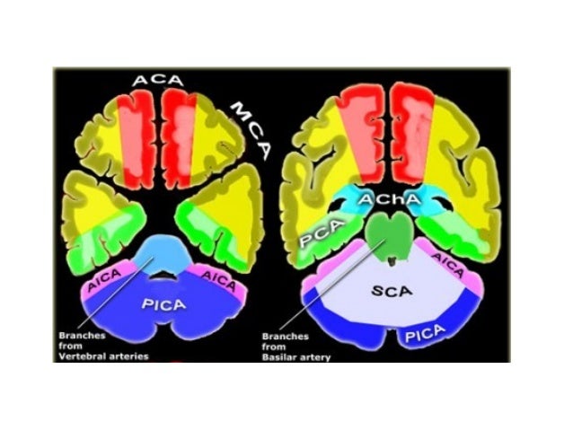 Diagnostic Imaging of Stroke