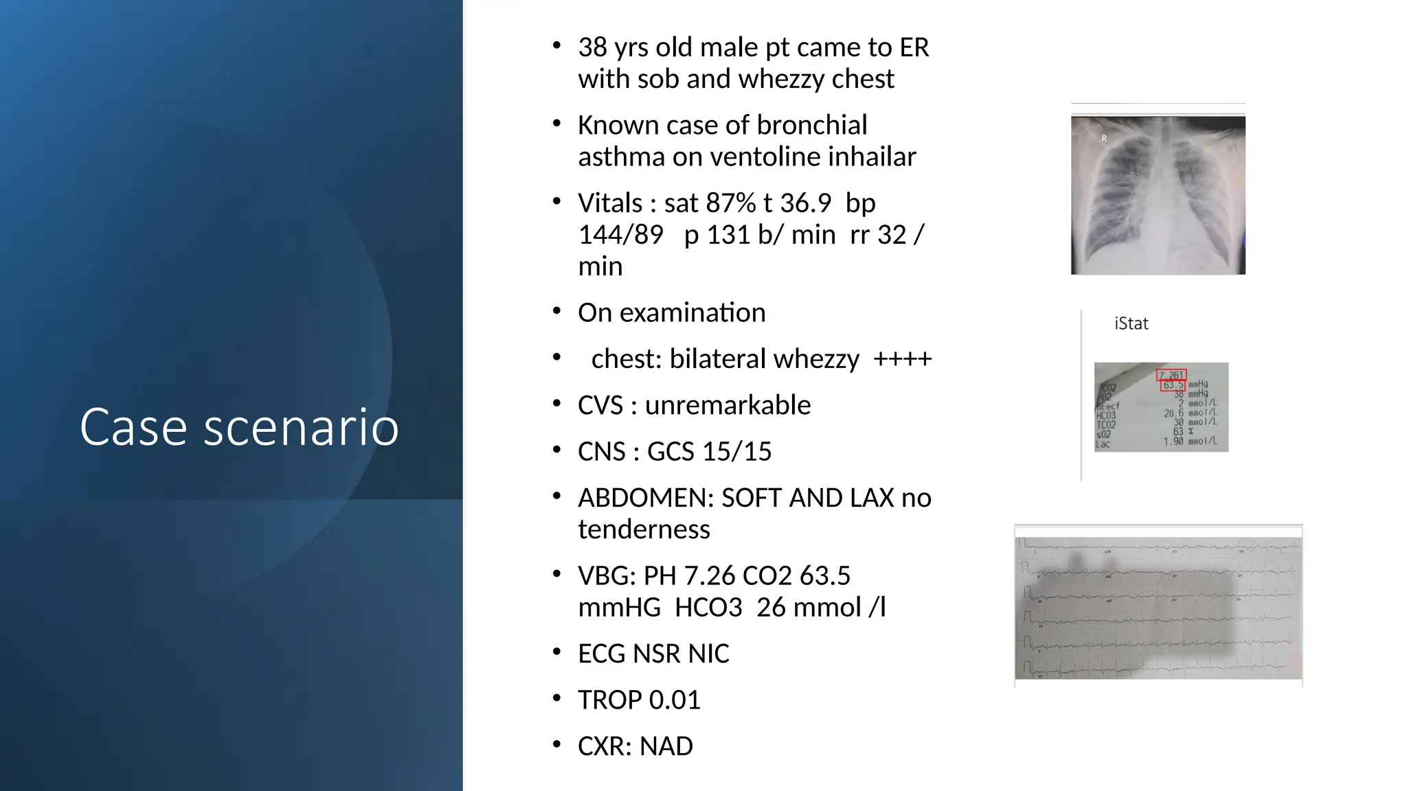 Acute asthma exacerbation presentation.pptx