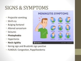 Acute bacterial meningitis - clinical presentation | PPTX