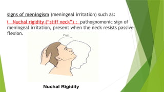 ACUTE BACTERIAL MENINGITIS FOR MICROBIOLOGY | PPT