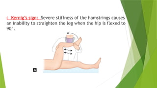 ACUTE BACTERIAL MENINGITIS FOR MICROBIOLOGY | PPT