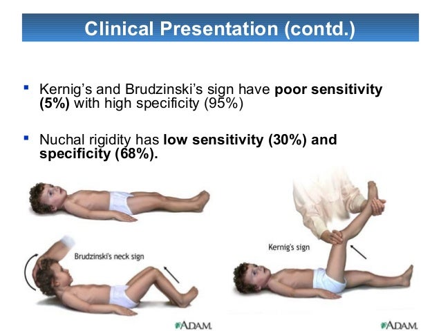 Acute bacterial meningitis seminar swastik