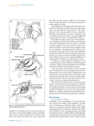 Acute bacterial sinusitis in children | PDF