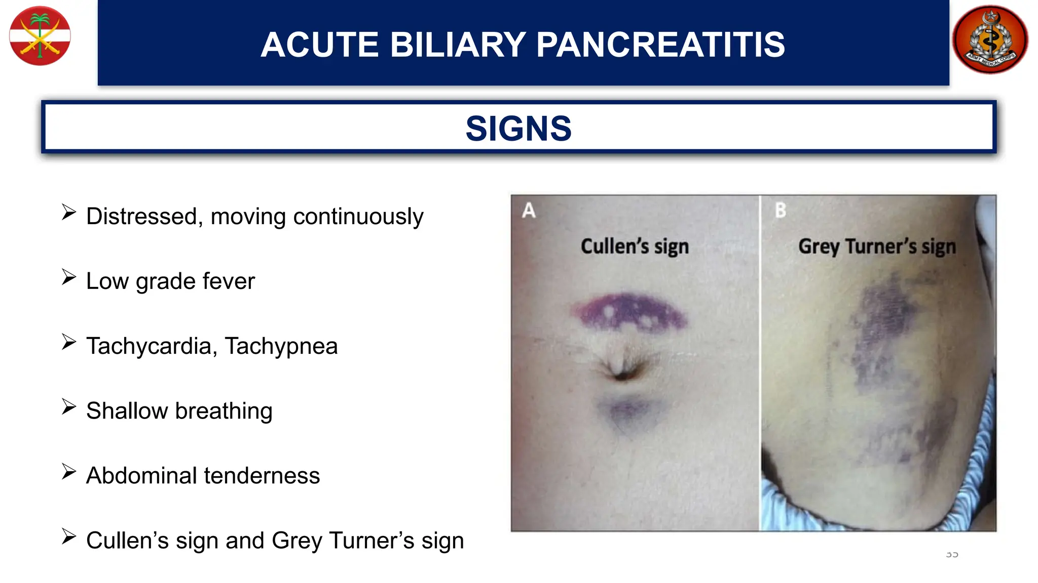 Symptoms management to investigation of acute biliary pancreatitis.pptx