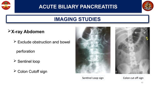 Symptoms management to investigation of acute biliary pancreatitis.pptx