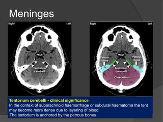 Acute brain | PPTX