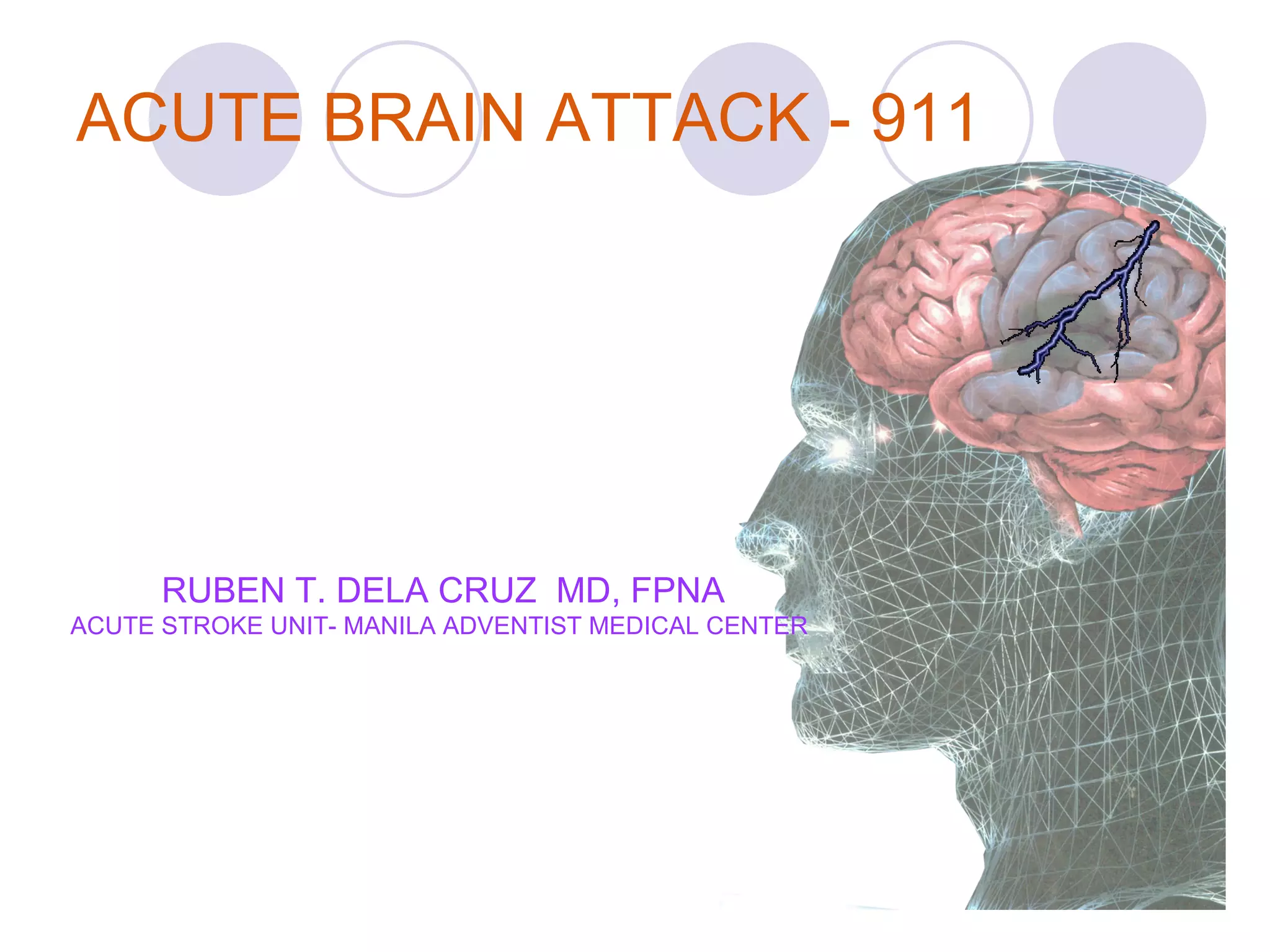 Acute brain attack 911 | PPT
