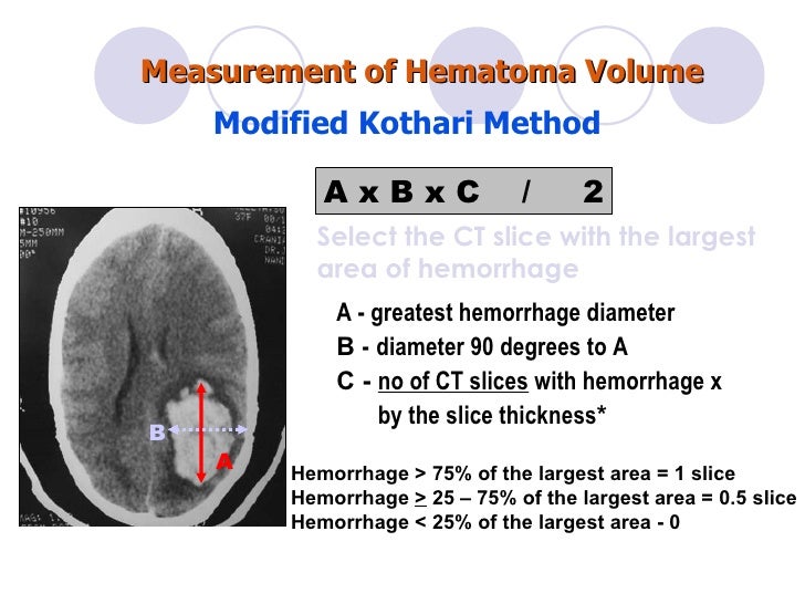 Acute brain attack 911