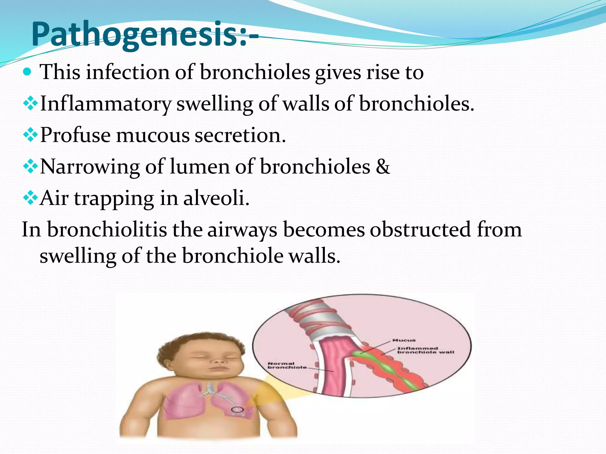Acute bronchiolitis | PPT