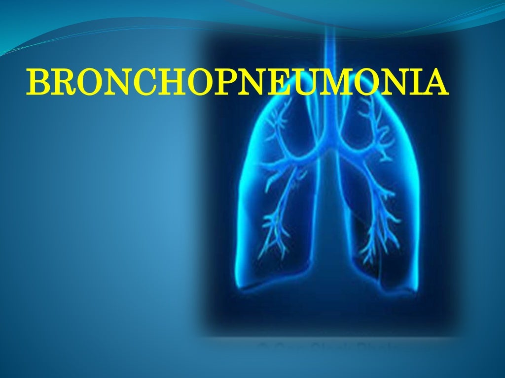 a case presentation on Acute bronchopneumonia