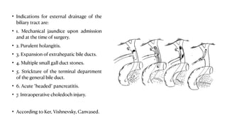 Acute calculosis cholecystitis in general medicine | PPT