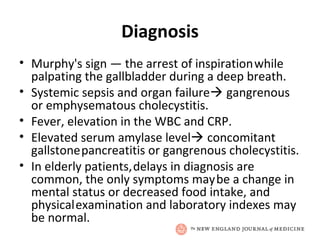 Acute Calculous Cholecystitis | PPT
