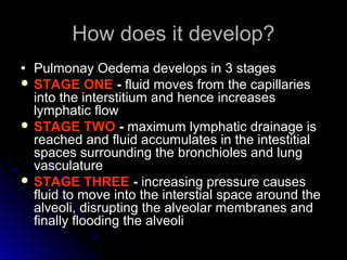 Acute Cardiogenic Pulmonary Oedema - (ACPO) | PPT