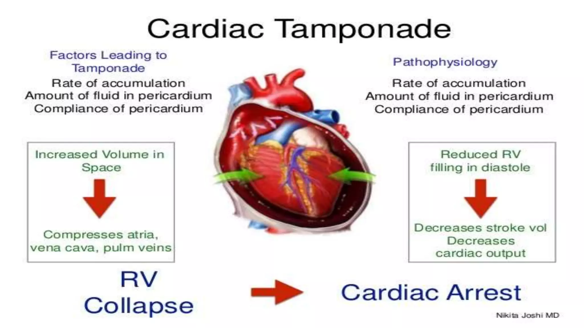 Acute cardiovascular disorders | PPT