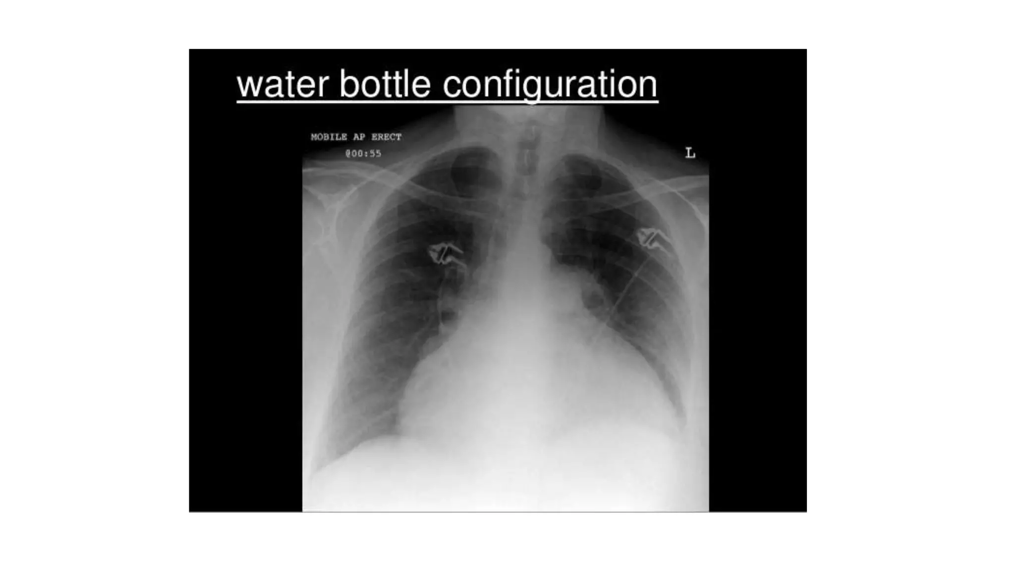 Acute cardiovascular disorders | PPT