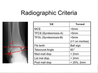 Acute care Ankle Fractures and how to treat them | PPT