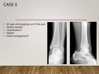 Acute care Ankle Fractures and how to treat them | PPT