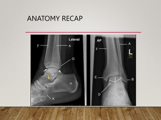 Acute care Ankle Fractures and how to treat them | PPTX