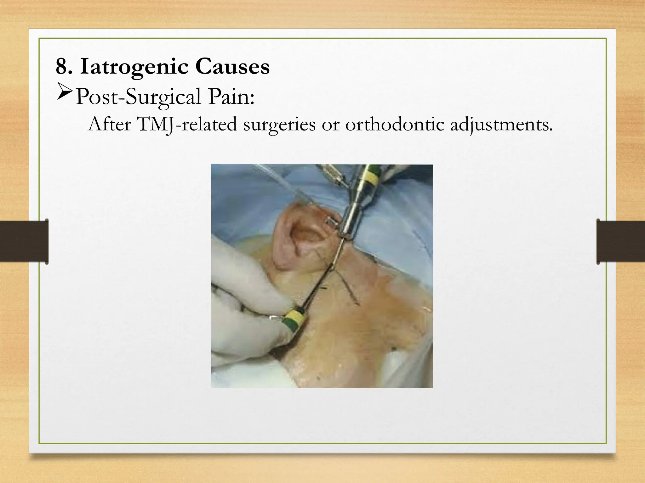 Acute causes of tmj tempromandibular joint pain.pptx