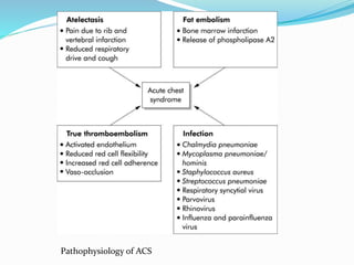 Acute chest syndrome | PPTX