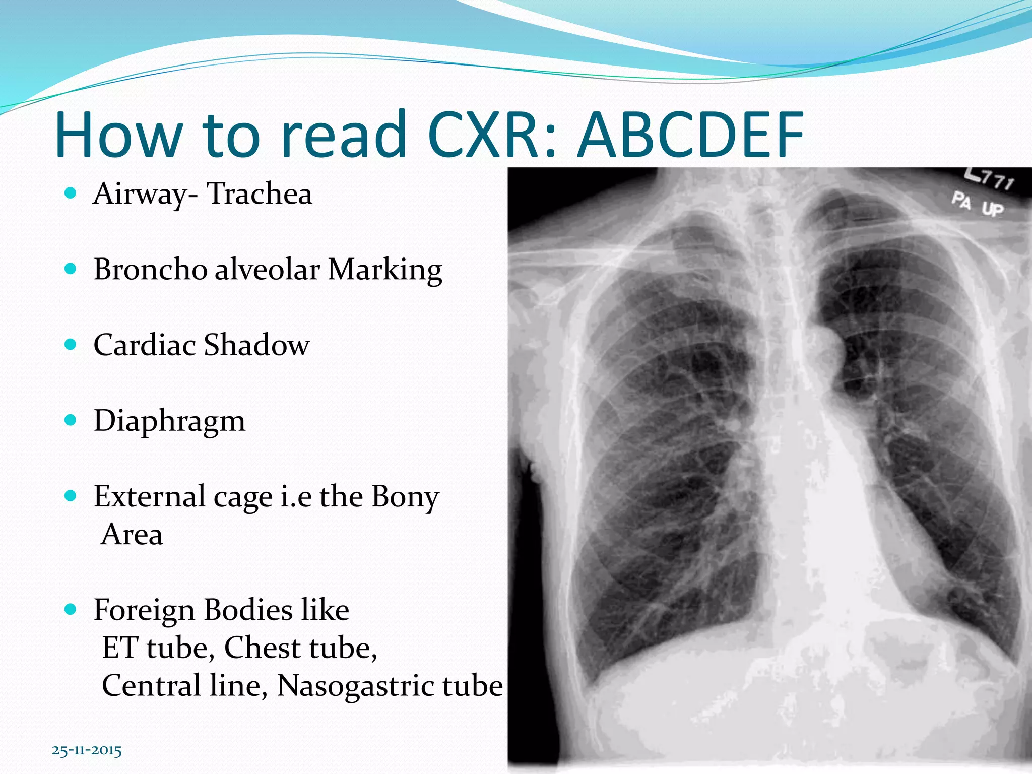 Acute chest trauma PPT By Dr Anil Kumar, Assistant Professor ,AIIMS ...