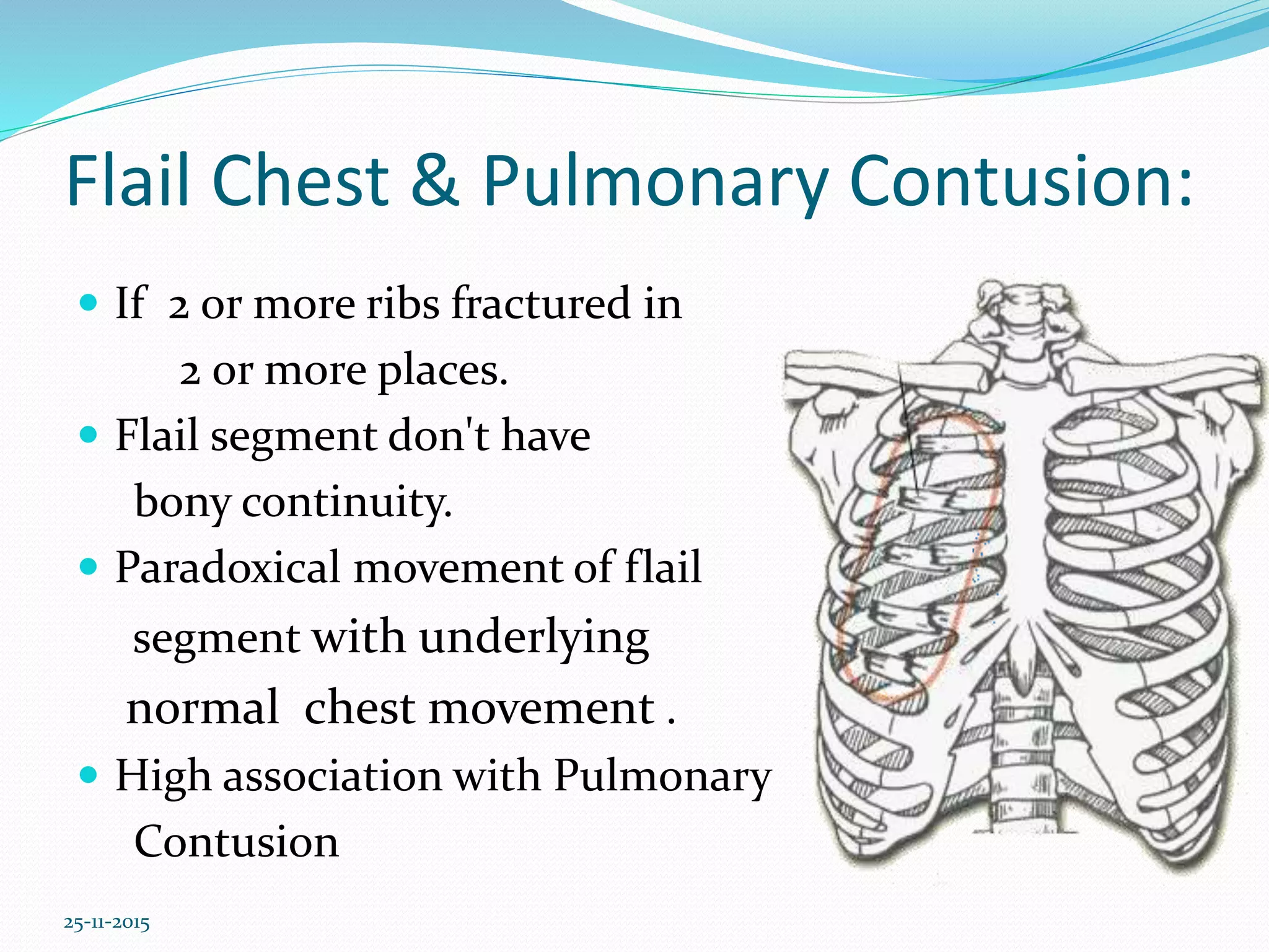 Acute chest trauma PPT By Dr Anil Kumar, Assistant Professor ,AIIMS ...