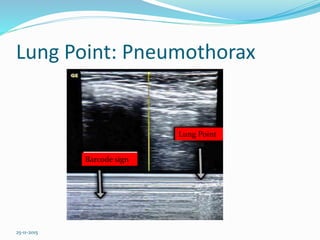 Acute chest trauma PPT By Dr Anil Kumar, Assistant Professor ,AIIMS ...