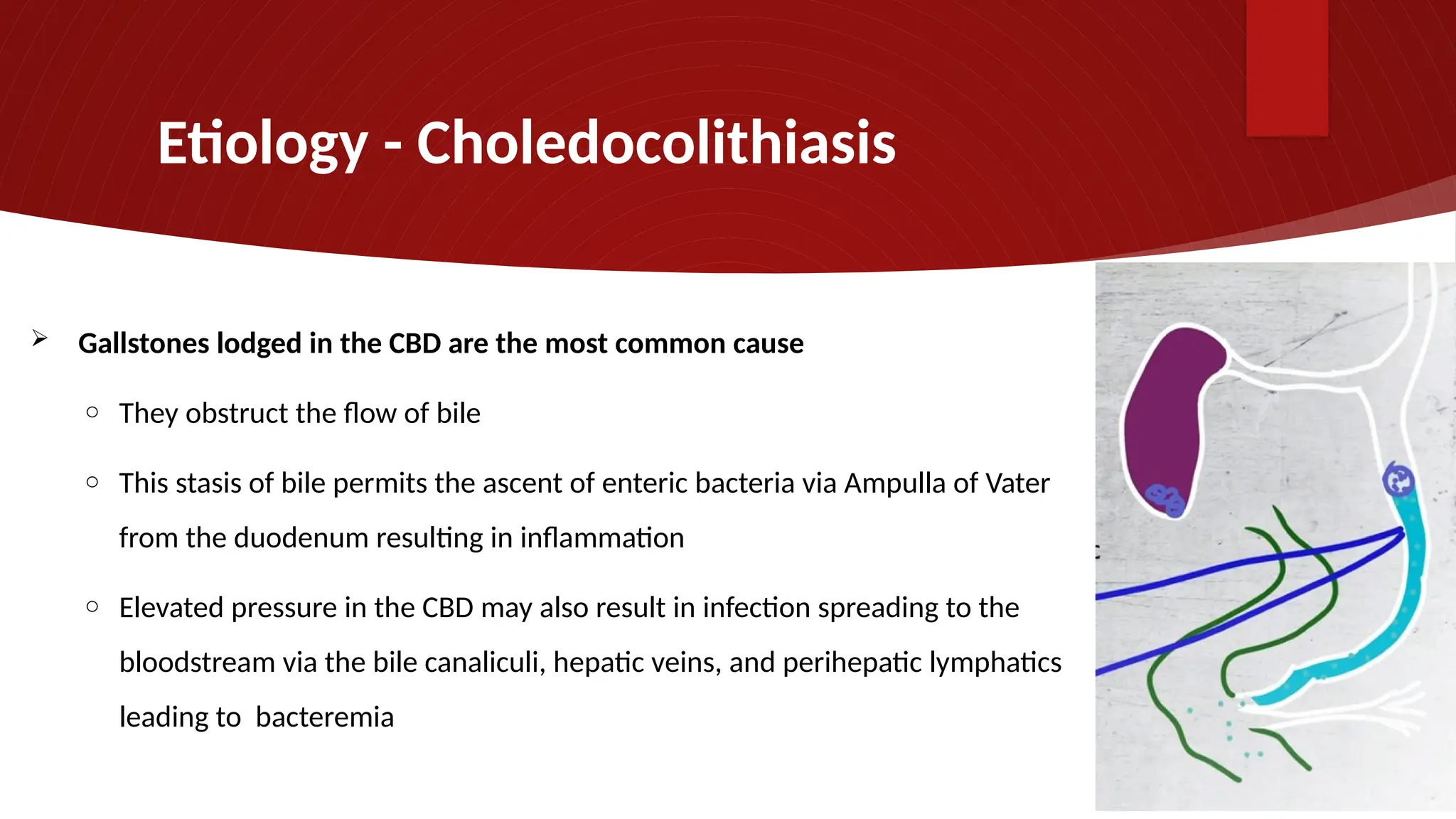 Acute Cholangitis Diagnostic Criteria And Management Pptx